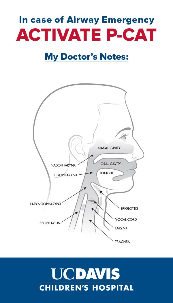 UC Davis IET - Illustration